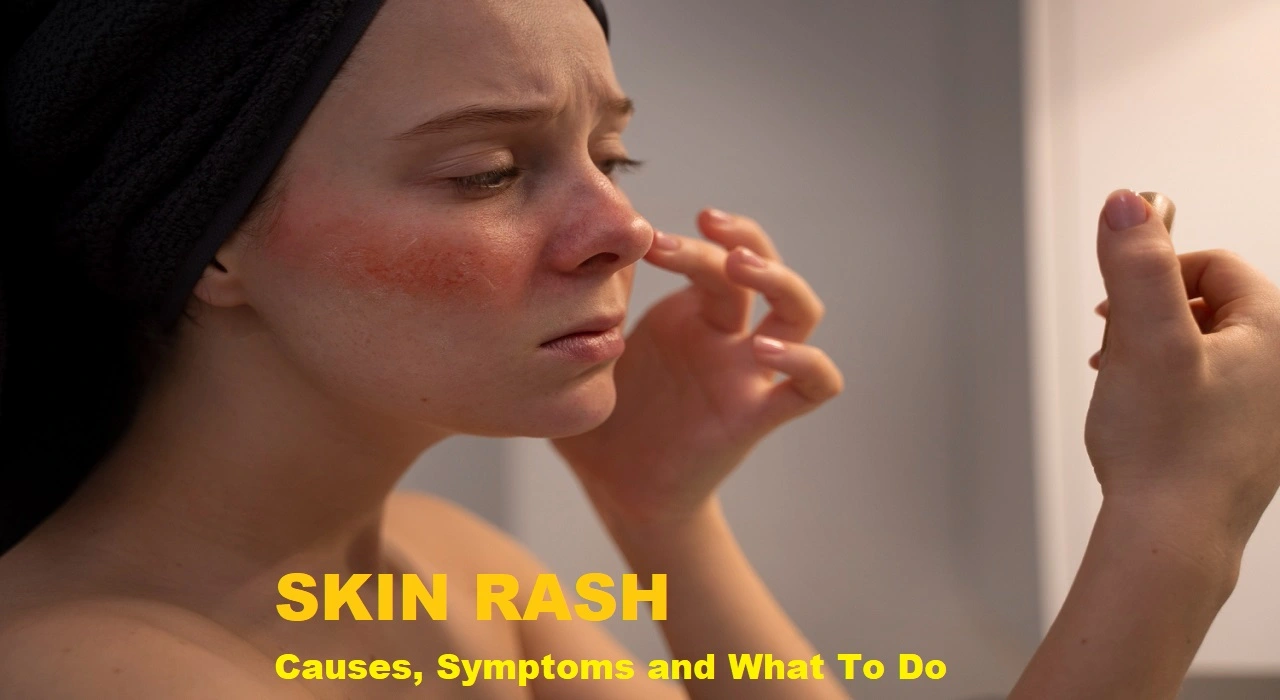 Skin rash: causes, symptoms & what to do - HealthyTips Skin rash: causes, symptoms & what to do - HealthyTips